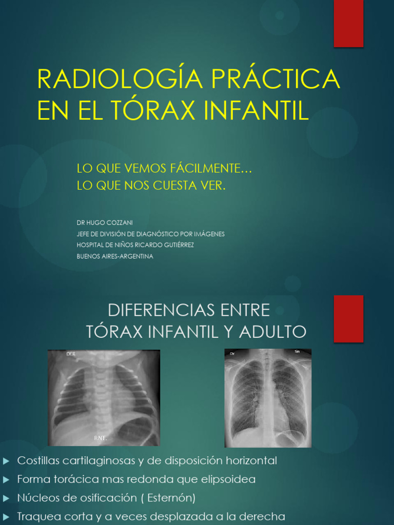 Radiología del Tórax Infantil | PDF | Tórax | Tórax (anatomía humana)