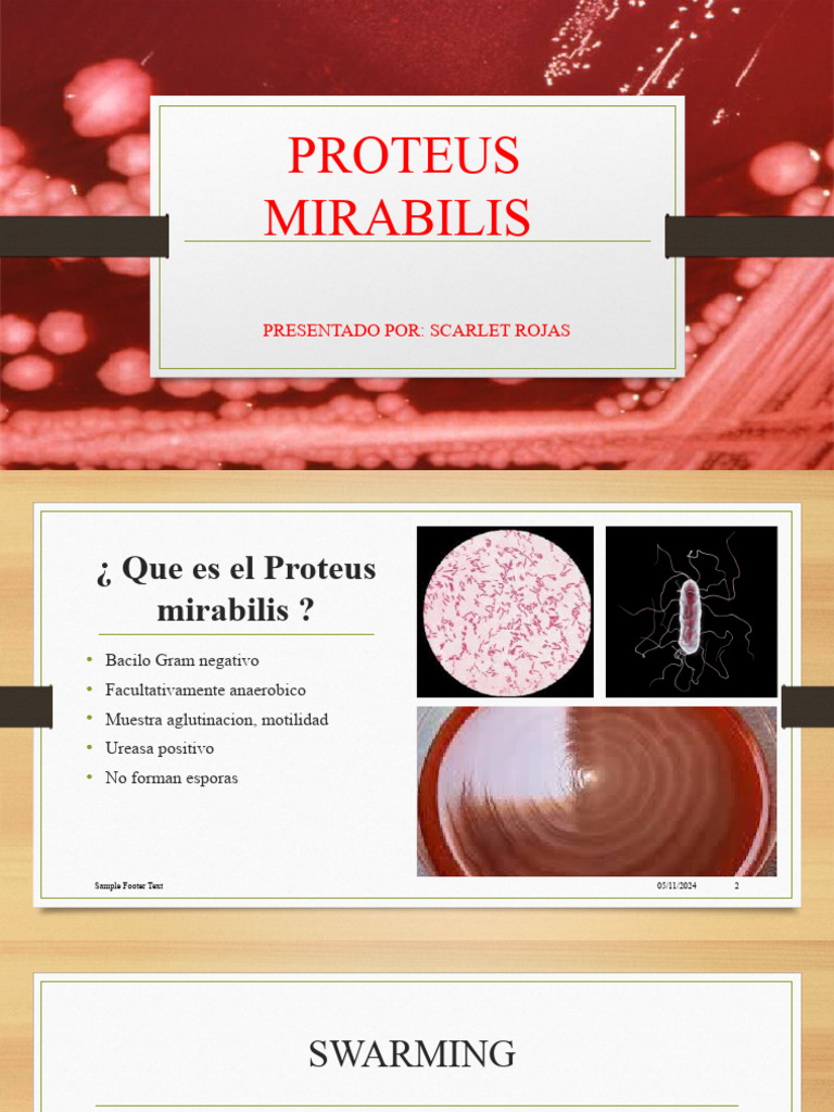 Proteus Mirabilis | PDF