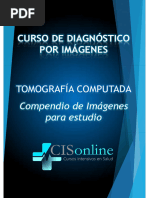 Tac Abdominopélvica Simple y Contrastada | PDF | Ct Scan | Medicina CLINICA