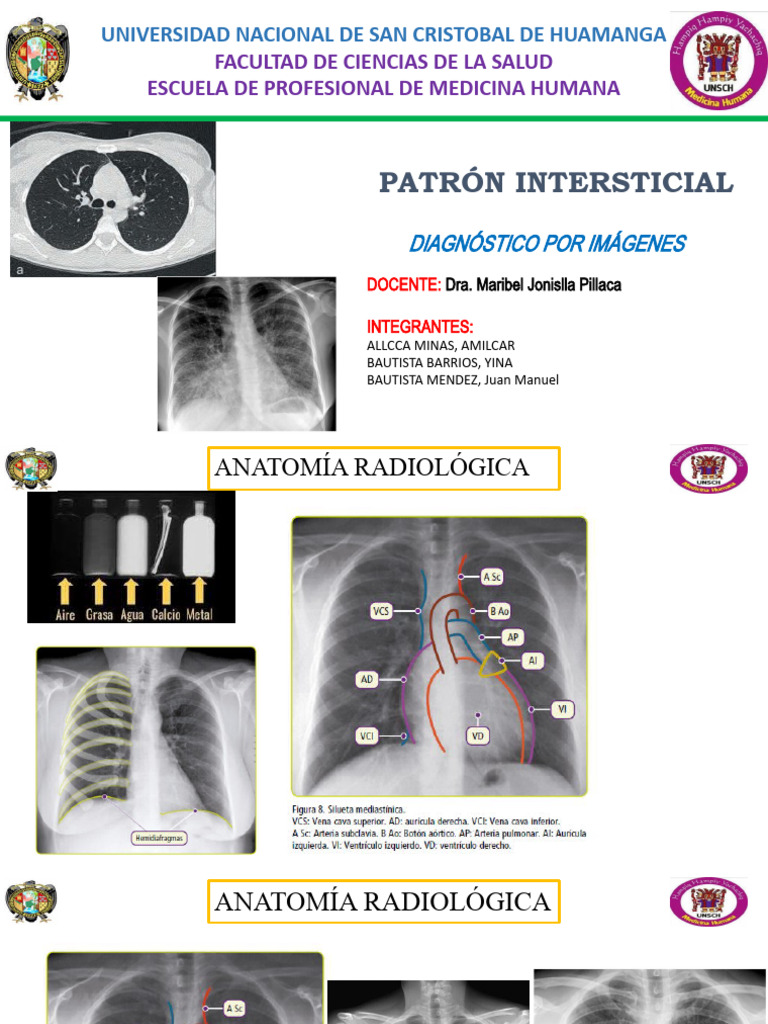 Patron Intersticial DX Imagenes Final | PDF | Pulmón | Medicina CLINICA
