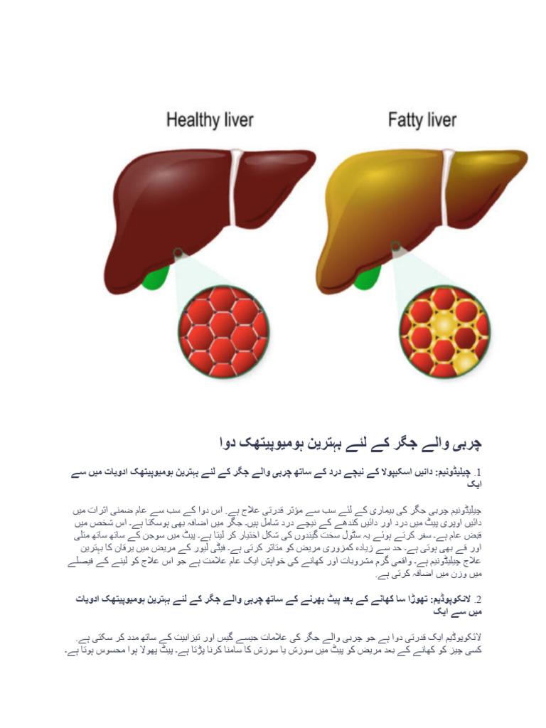 Fatty Liver | PDF