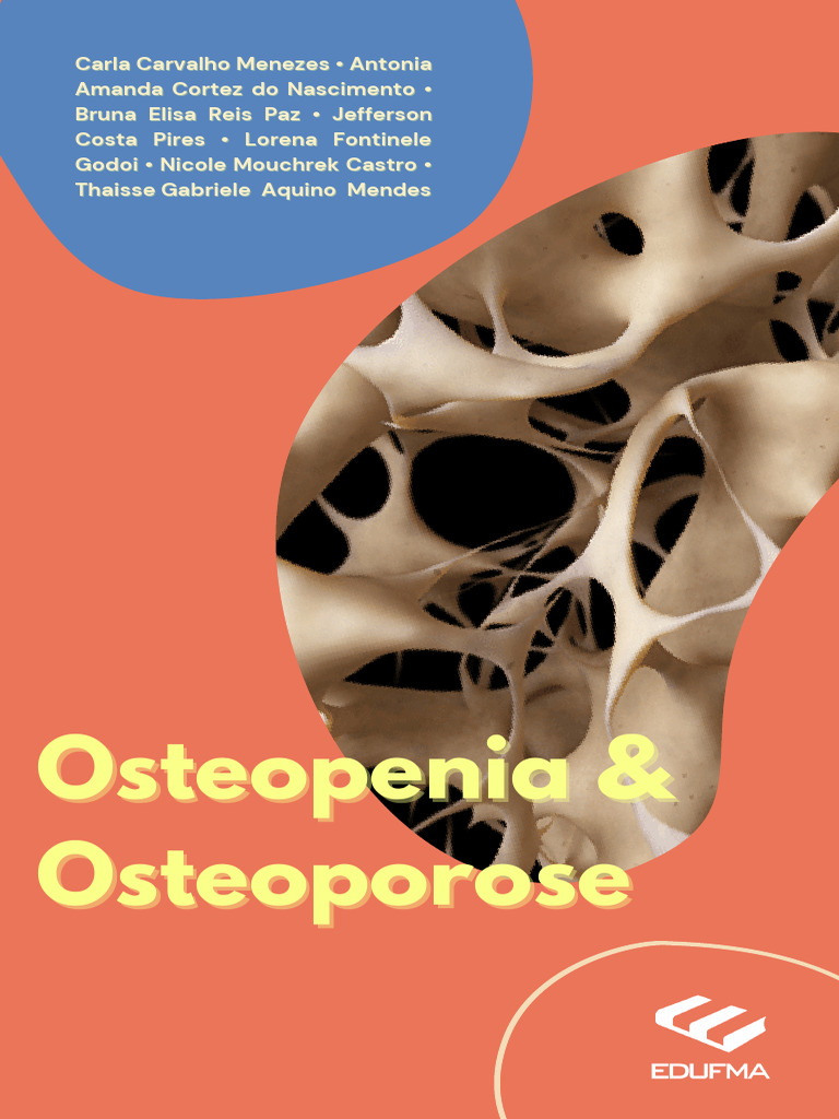 Osteopenia e Osteoporose | PDF | Osso | Osteoporose
