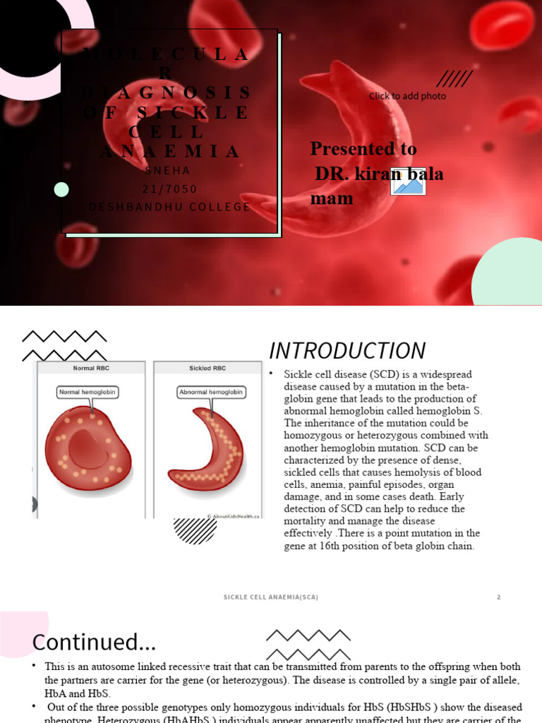 Sickle Cell Anaemia | PDF | Molecular Biology | Blood