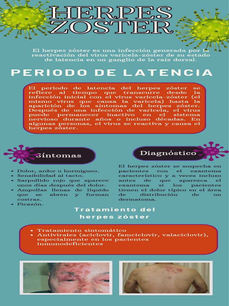 Síntomas y tratamiento del herpes zóster | PDF