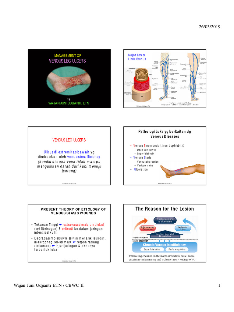 Venous Leg Ulcer Management Guide | PDF