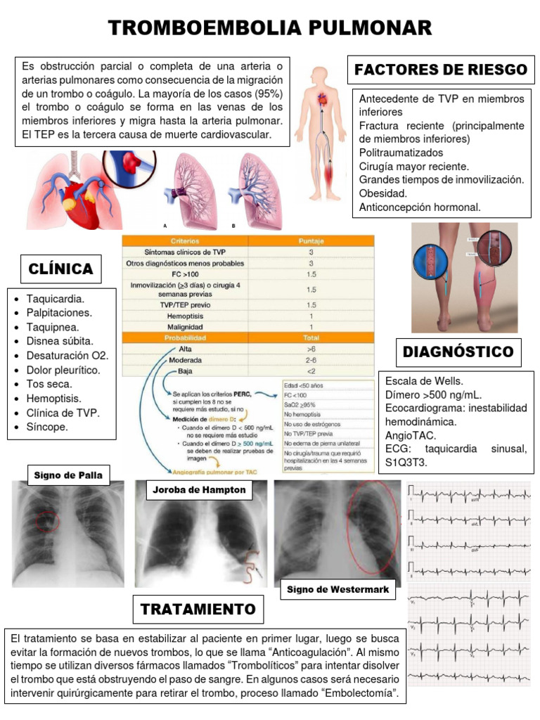 Infografía de Tromboembolia Pulmonar | Descargar gratis PDF | Medicina ...