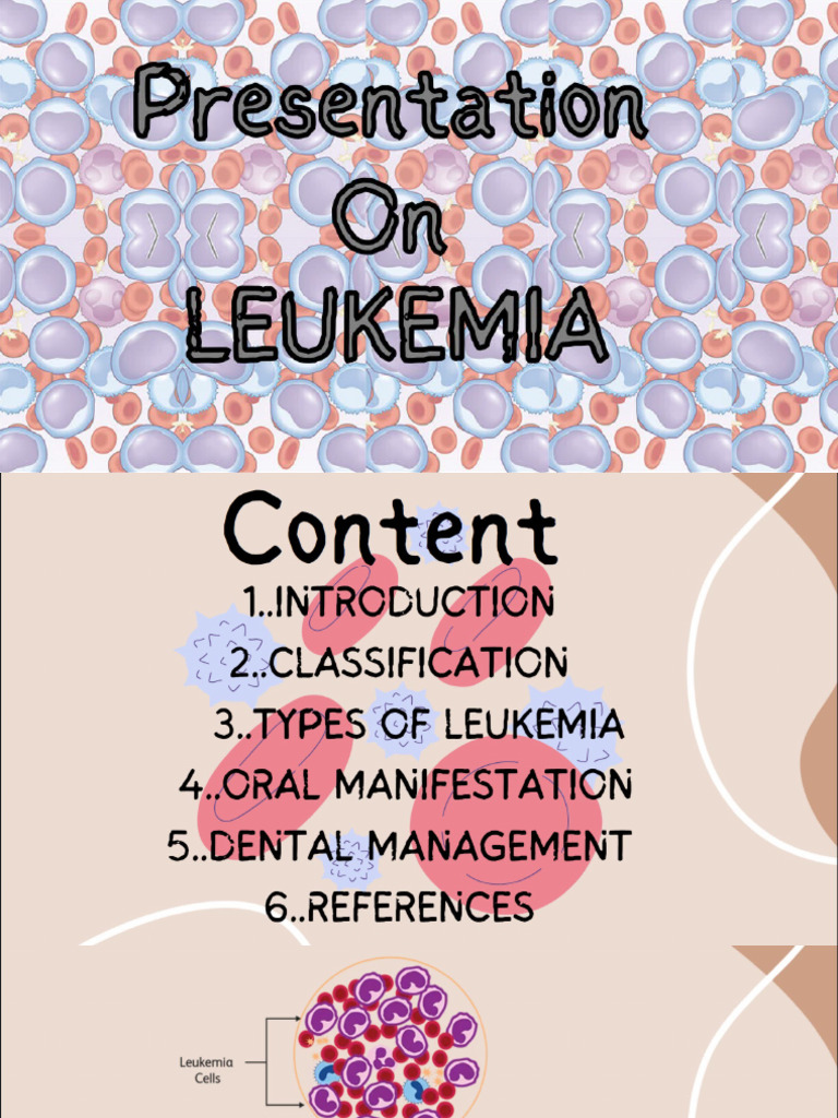 Leukemia | PDF