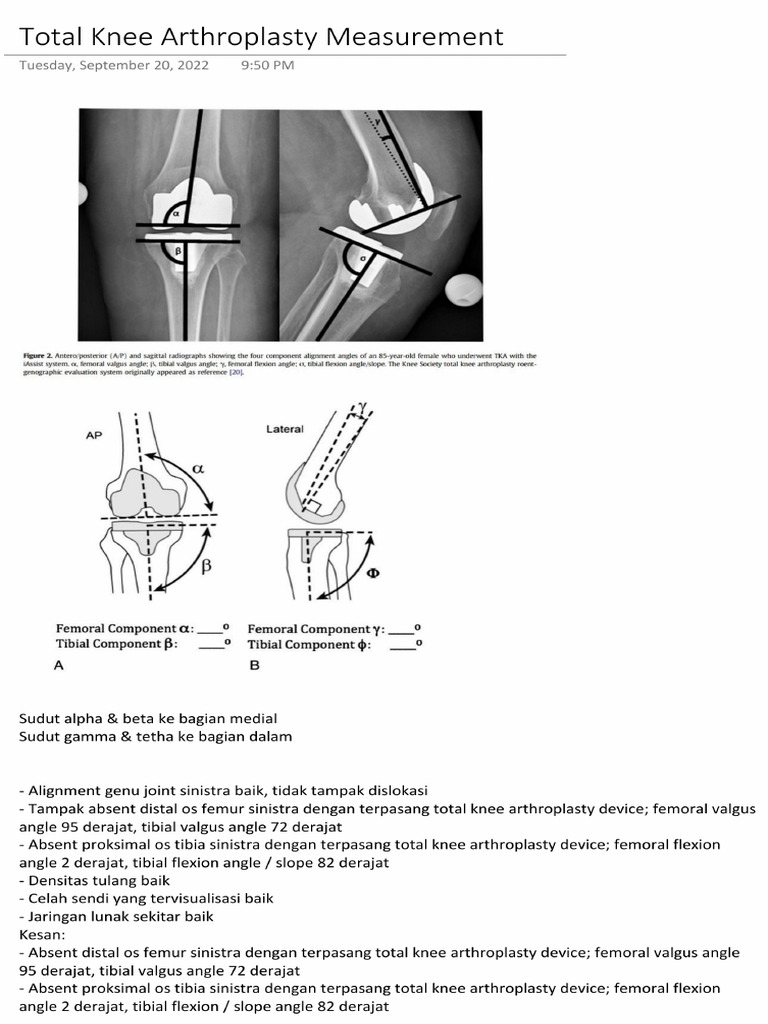 Total Knee Arthroplasty Measure | PDF