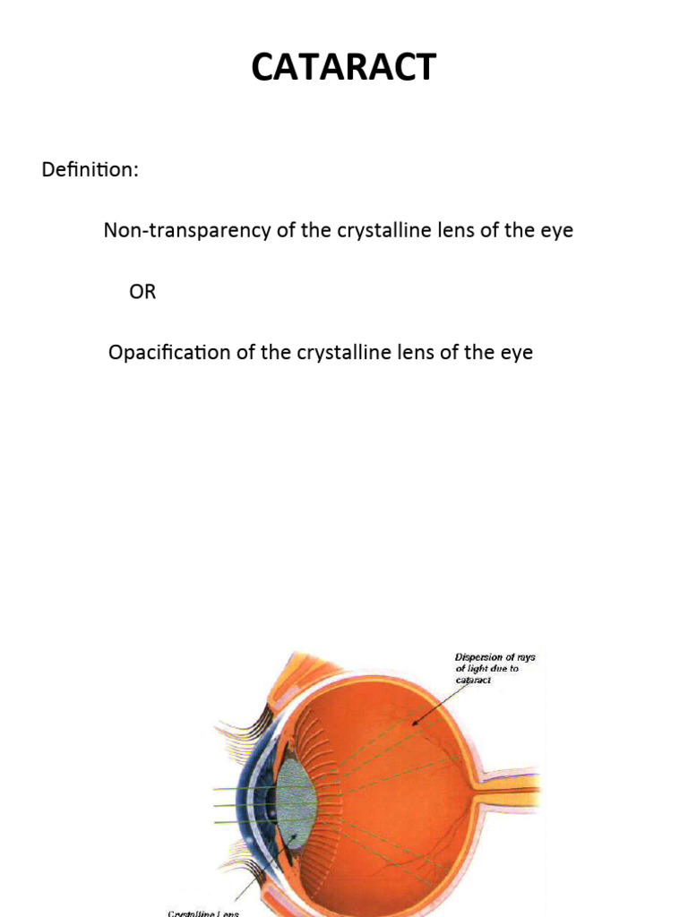 CATARACT | PDF | Clinical Medicine | Causes Of Death