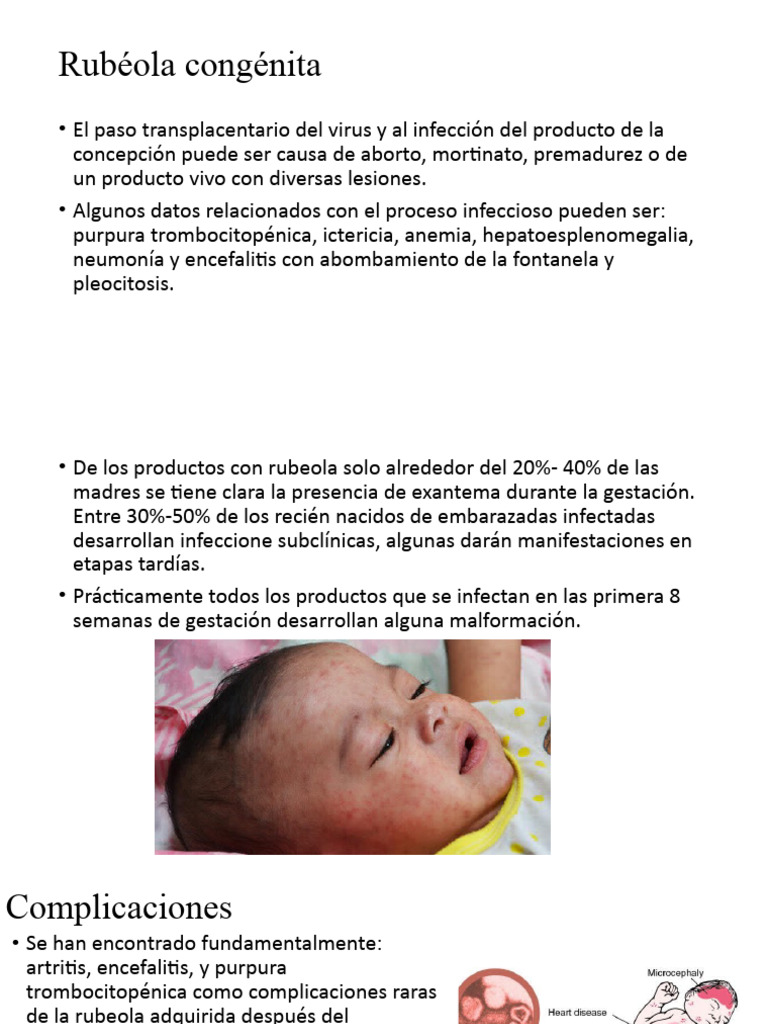Rubéola Congénita: Diagnóstico y Complicaciones | PDF | Enfermedades y ...