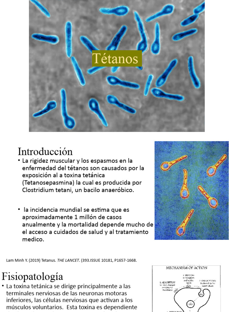 Tétanos: Síntomas, Tratamiento y Fisiopatología | PDF | Especialidades ...