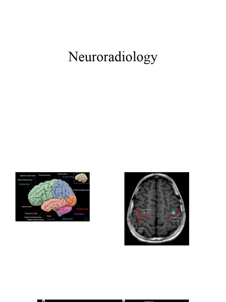 Neuroradiology: Key Variants & Techniques | PDF | Science & Mathematics | Religion & Spirituality