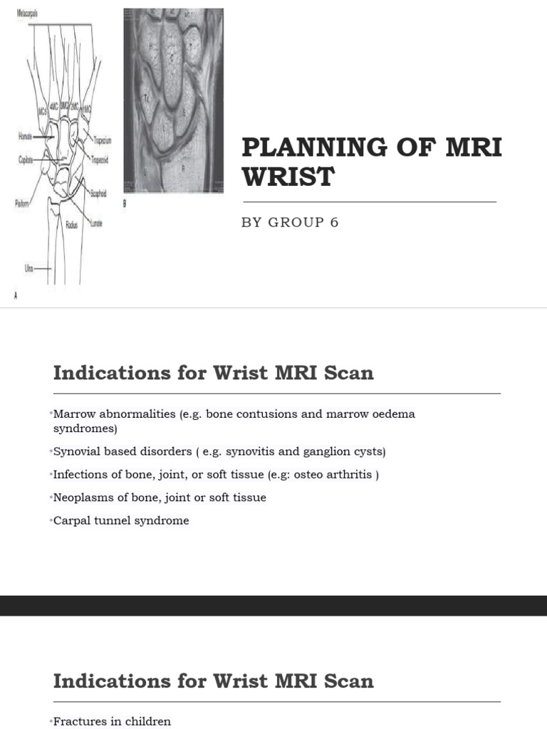 Planning of Mri Wrist | PDF | Magnetic Resonance Imaging | Hand