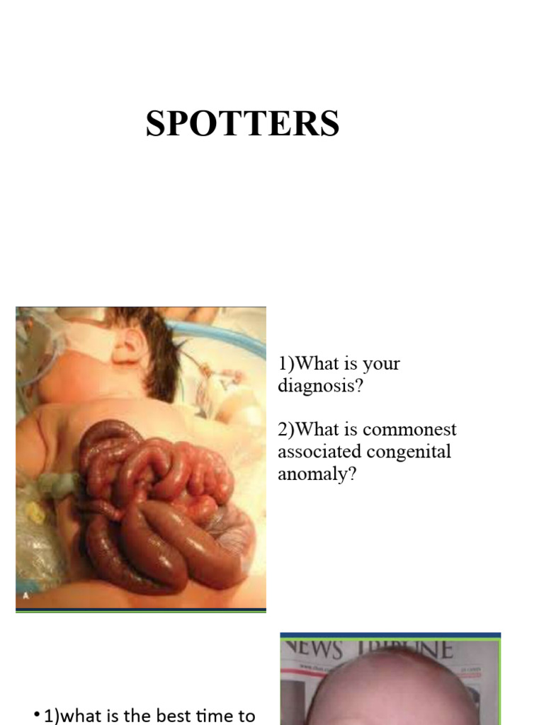 Spotters | PDF