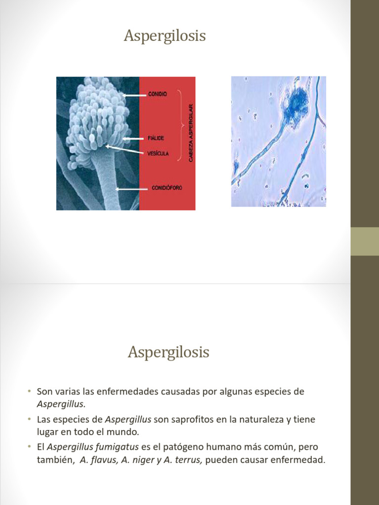 Aspergilosis: Tipos, Diagnóstico y Tratamiento | PDF | Tos | Trasplante de células madre ...