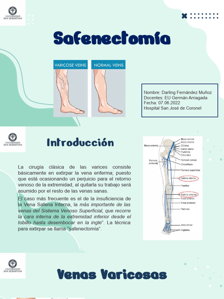 EBE Safenectomia | PDF | Venas varicosas | Cirugía