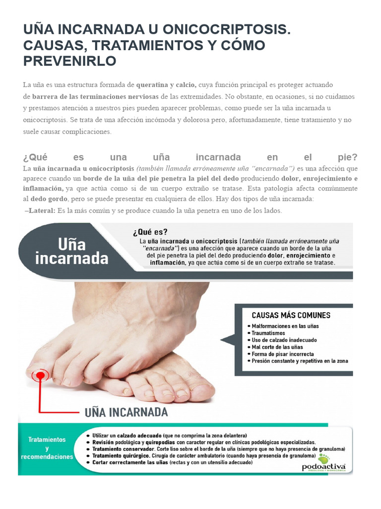 Tratamiento y prevención de onicocriptosis | PDF | Clavo (anatomía ...