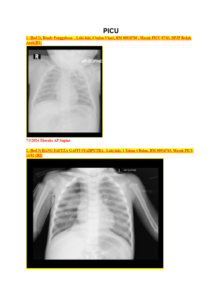 Foto Thorax PICU HCU 6 Maret 2024 | PDF | Sains & Matematika