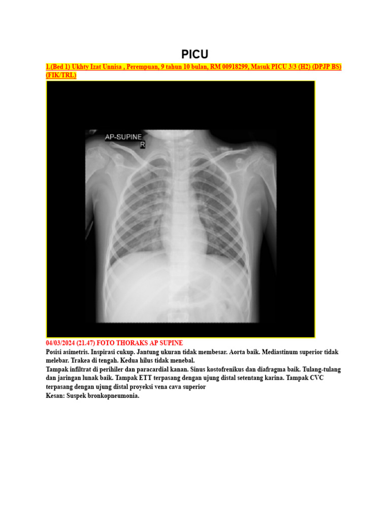 Foto Thorax PICU - HCU 5 - 3 - 2024 | PDF