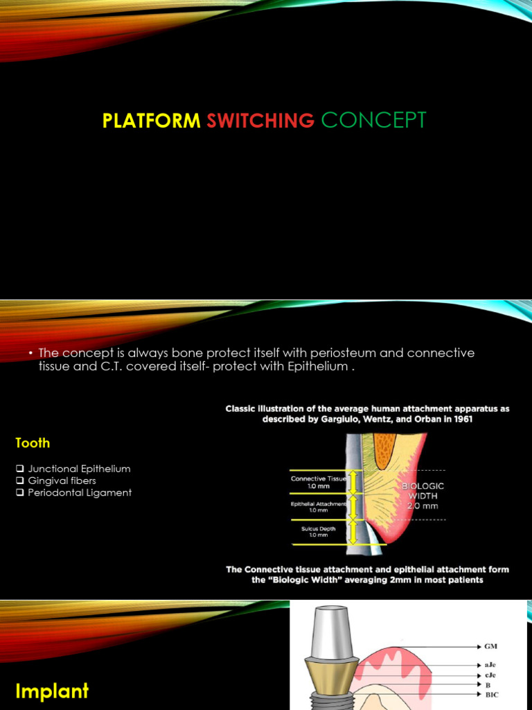 Platform Swiching Implant Lecture | PDF | Dental Implant | Mouth