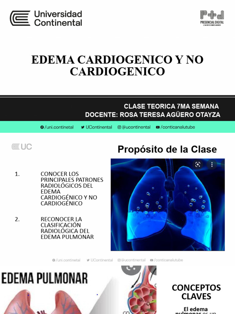 Edema Pulmonar: Tipos y Diagnóstico Radiológico | PDF | Edema ...
