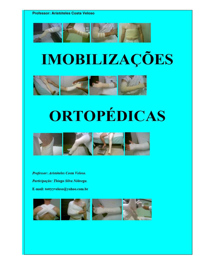 Apostila de Imob Ortopedicas | PDF | Joelho | Cirurgia ortopédica