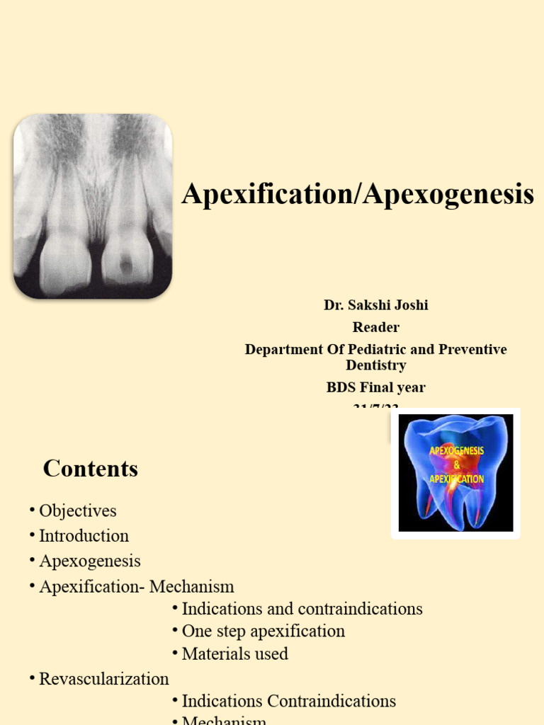 Apexification vs. Apexogenesis Overview | PDF | Dentistry | Dentistry ...