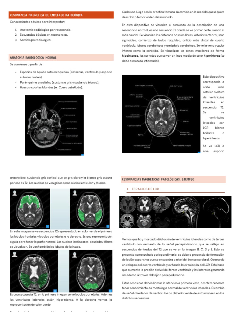 Resonancia Magnetica de Encefalo Patológica | PDF | Fluido cerebroespinal | Cerebro