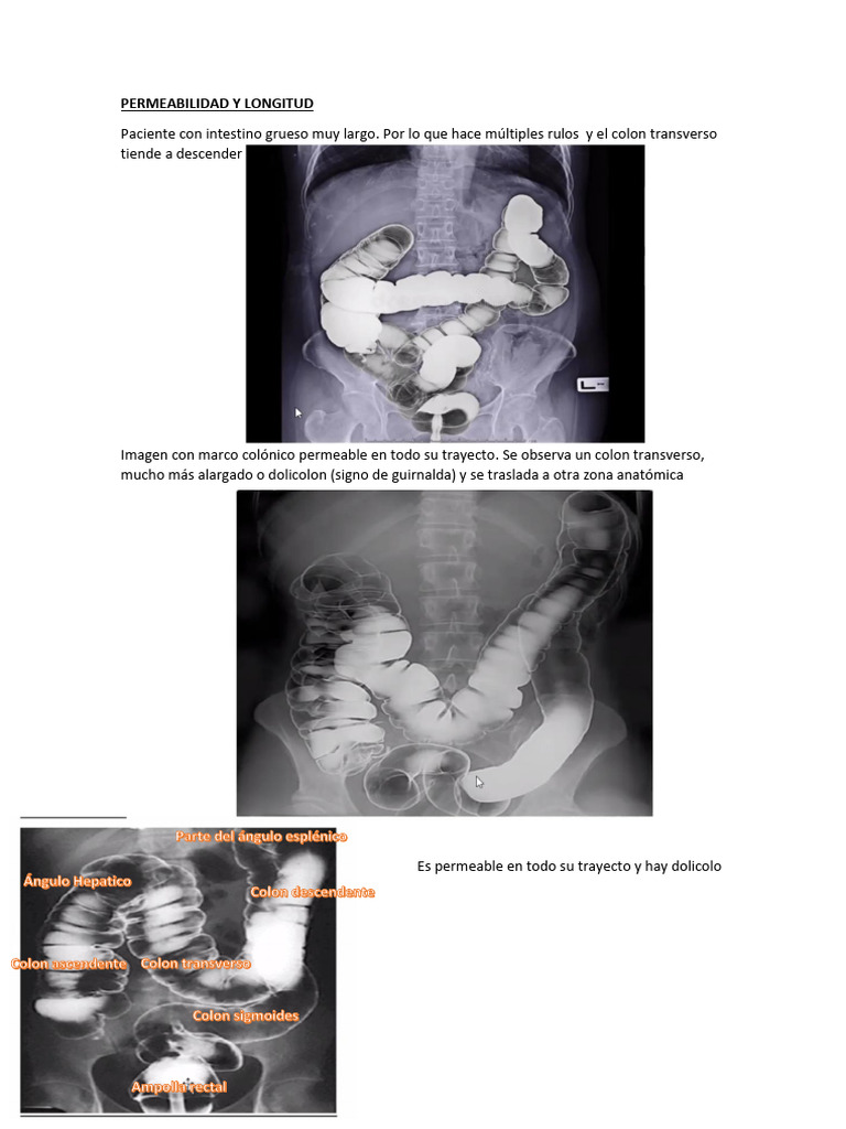 Colon X Enema | PDF | Intestino grueso | Cáncer colonrectal
