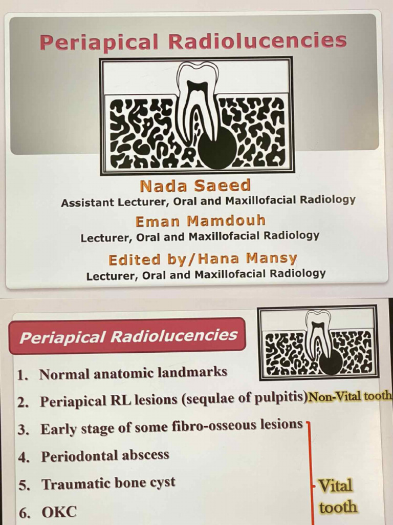 Oral Radiolucent Lesions | PDF