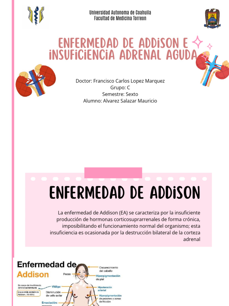 Tema 1 Enfermedad de Addison | PDF | Glándula suprarrenal | Corticosteroides