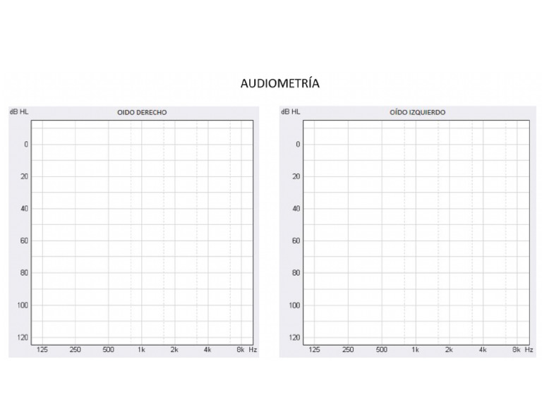 AUDIOMETRIA | PDF