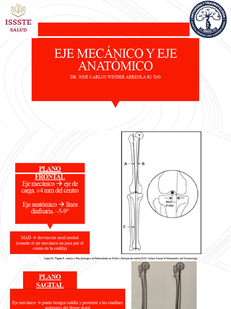 Ejes Mecánico y Anatómico de la Rodilla | PDF | Ciencia y matemáticas