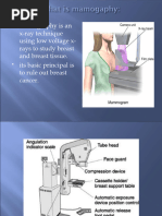 Extended Craniocaudal Laterally Rotated (XCCL) Projection in ...