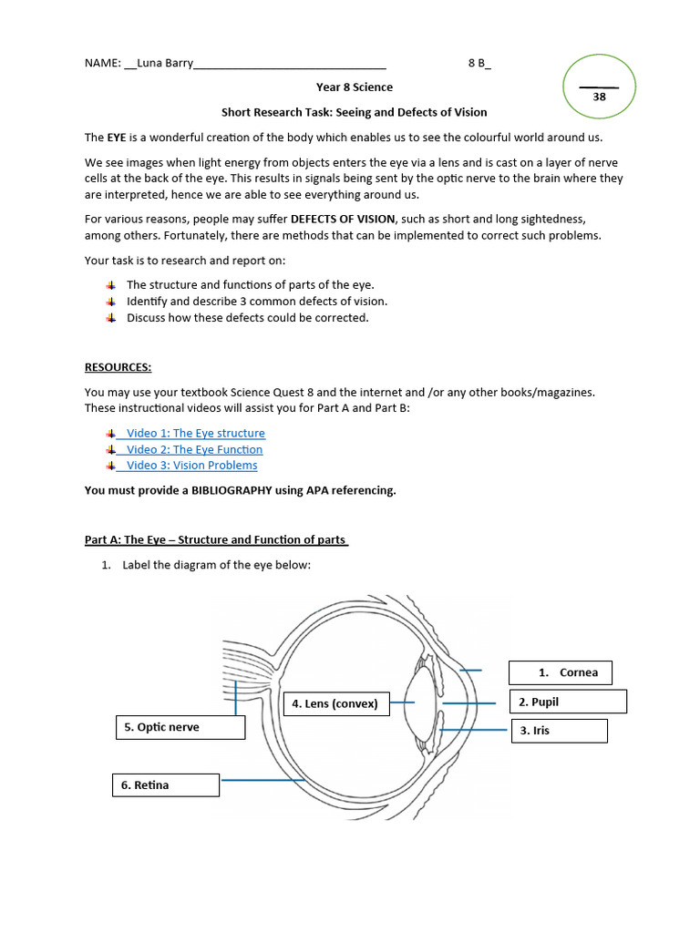 Eye Structure and Defects of Vision by Luna HW | PDF | Eye | Myopia