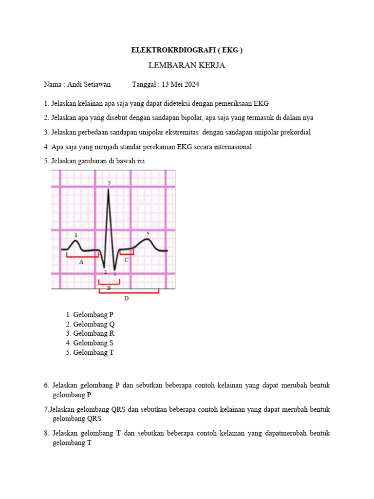Interpretasi Hasil EKG Jantung Koroner | PDF