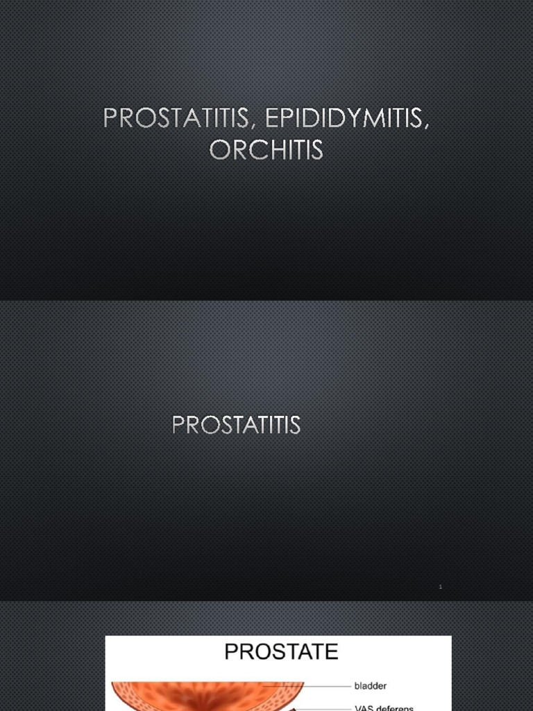 Types and Causes of Prostatitis | PDF | Urinary Tract Infection ...