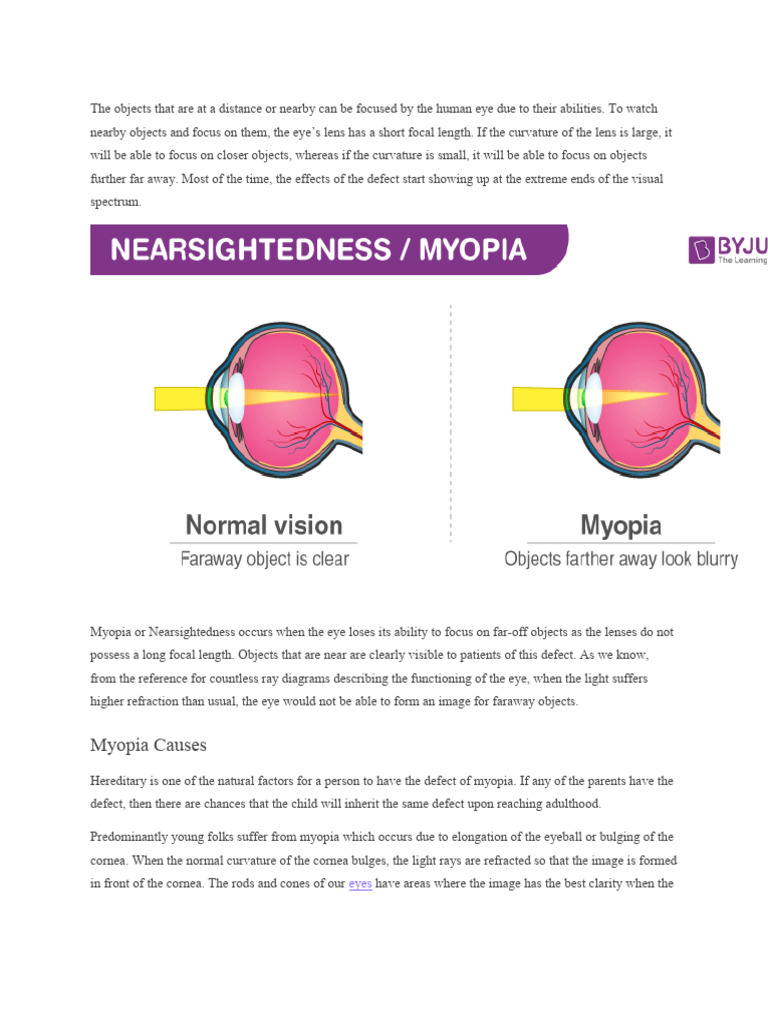 Myopia Causes | PDF | Myopia | Cataract