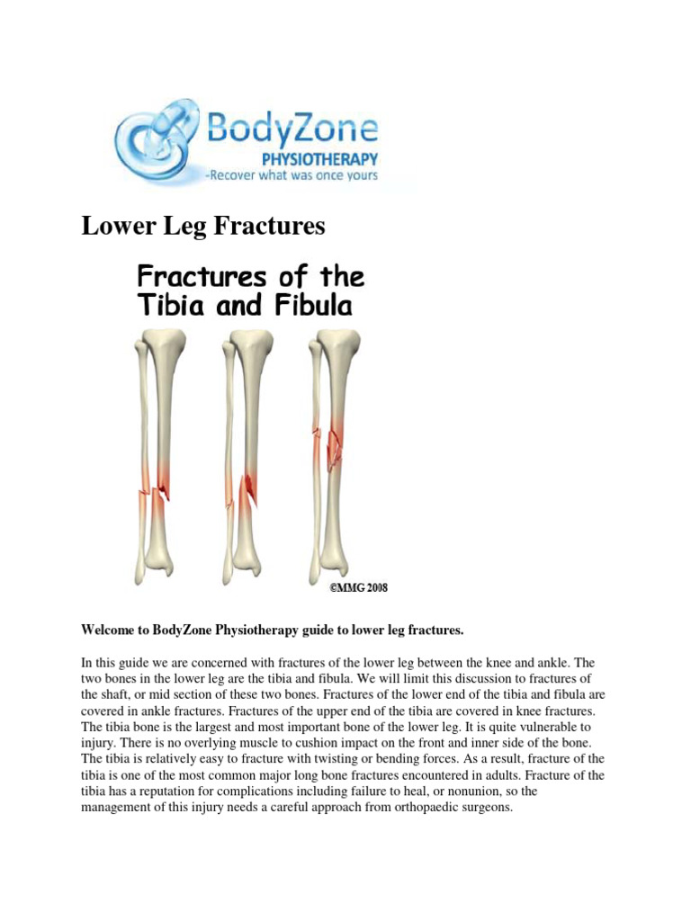 Lower Leg Fractures | PDF | Physical Therapy | Knee