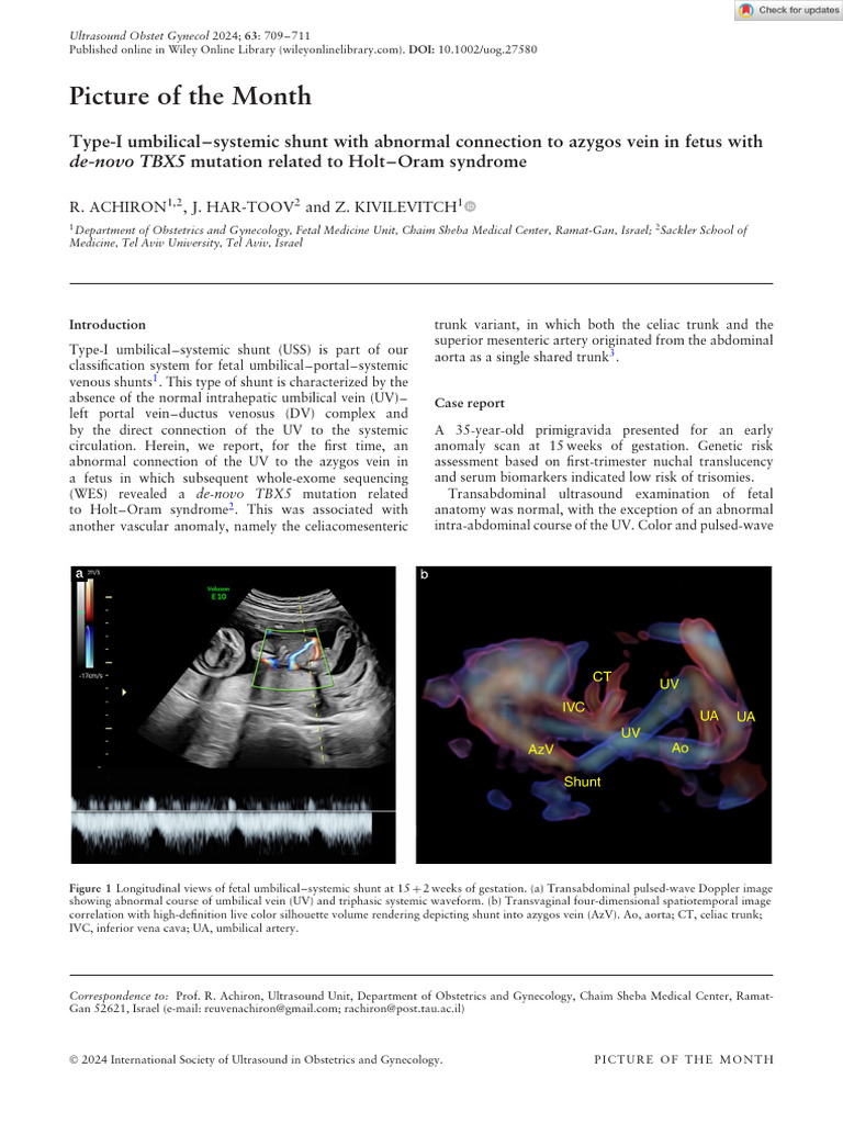 Ultrasound in Obstet Gyne - 2024 - Achiron - Type I Umbilical Systemic Shunt With Abnormal ...