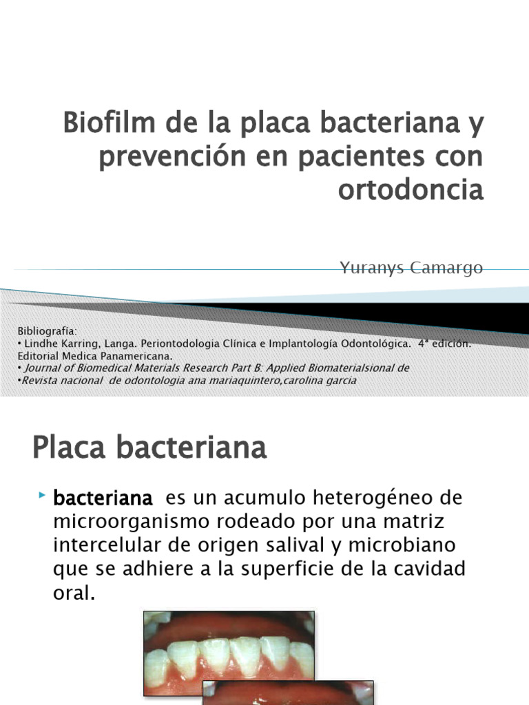 Biofilm de La Placa Bacteriana y Prevencion en | Descargar gratis PDF | Higiene oral | Cepillo ...
