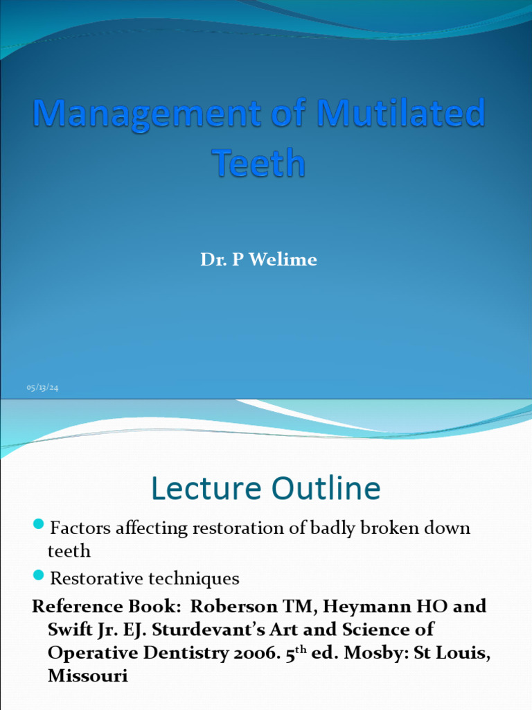 Restoration Techniques for Mutilated Teeth | PDF | Human Tooth | Dentistry