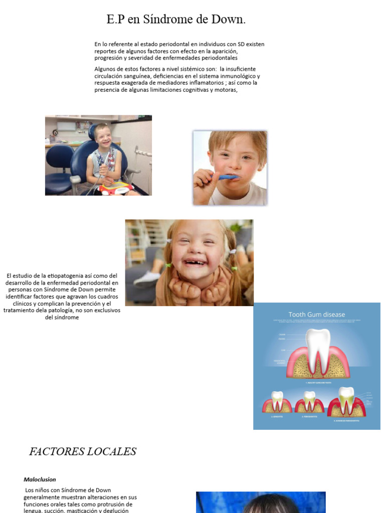 Enfermedad Periodontal en Síndrome de Down | PDF | Síndrome de Down ... Enfermedad Periodontal en Síndrome de Down | PDF | Síndrome de Down ...