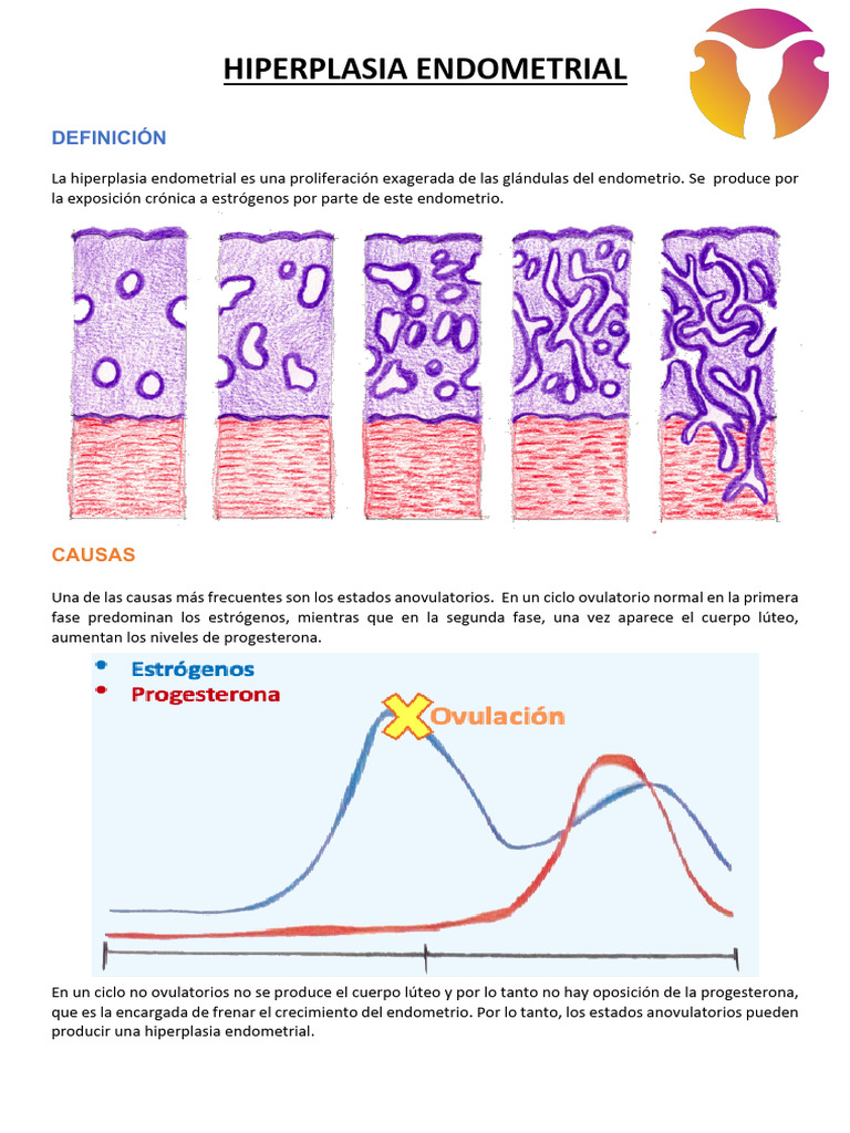 Hiperplasia Endometrial: Causas y Tratamiento | PDF | Enfermedades y ...