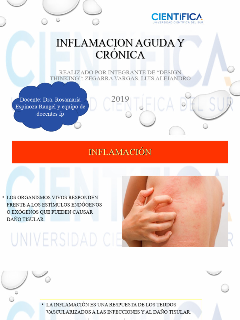 CLASE 2 - Inflamacion Aguda y Crónica | PDF | Inflamación | Macrófago