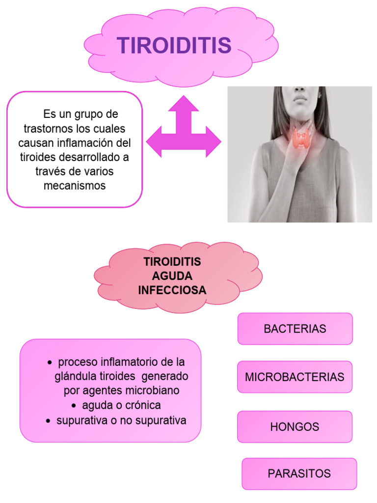 2 Tiroiditis | PDF | Tiroides | Ciencias de la Salud