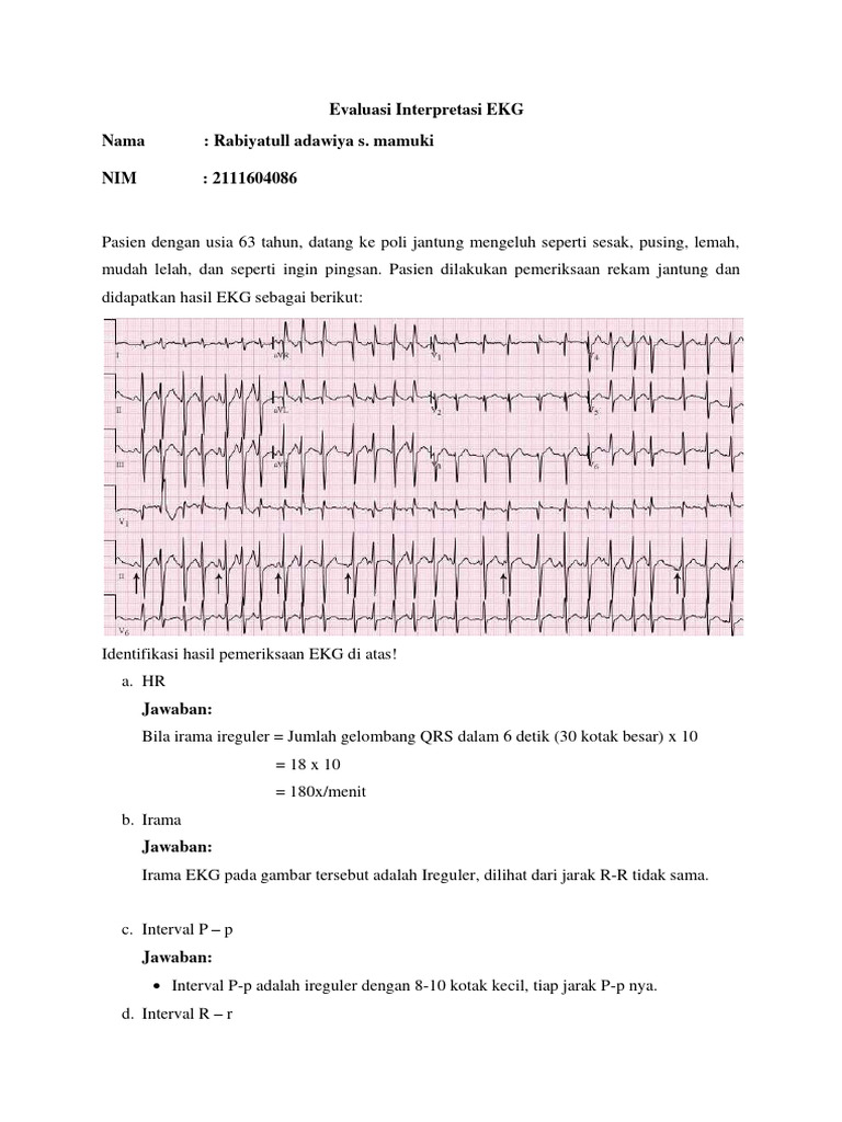 Evaluasi Interpretasi EKG | PDF | Sains & Matematika