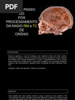 Exames de Ressonância Magnética e Angio-RM | PDF | Coluna vertebral | Anatomia