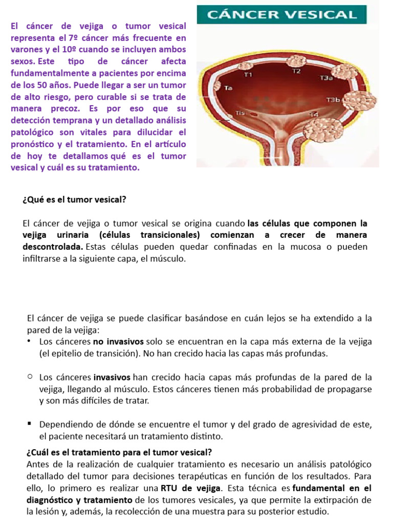 Cancer Vesical | PDF | Cáncer | Antígeno específico de la próstata