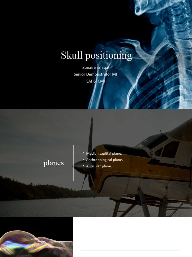 Skull Positioning | PDF